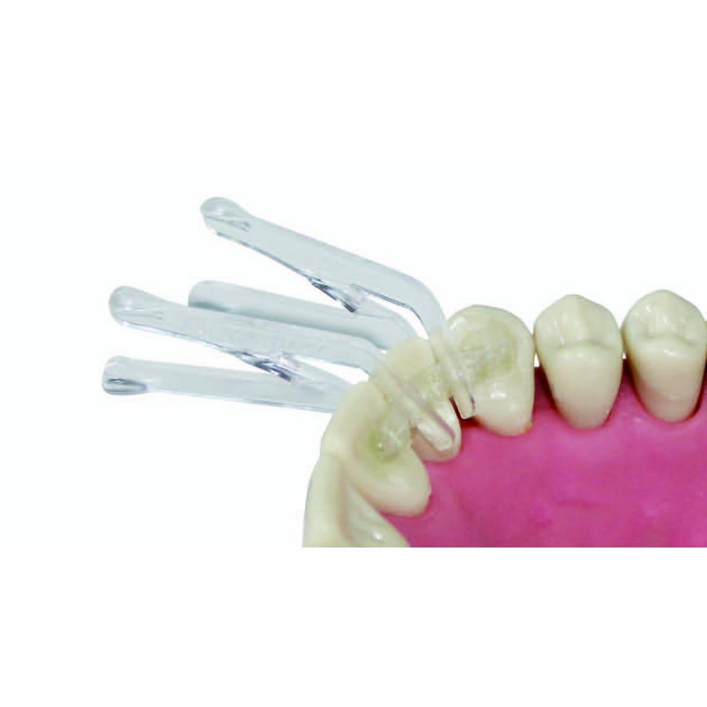 Clip&Splint klemmen - Deprophar