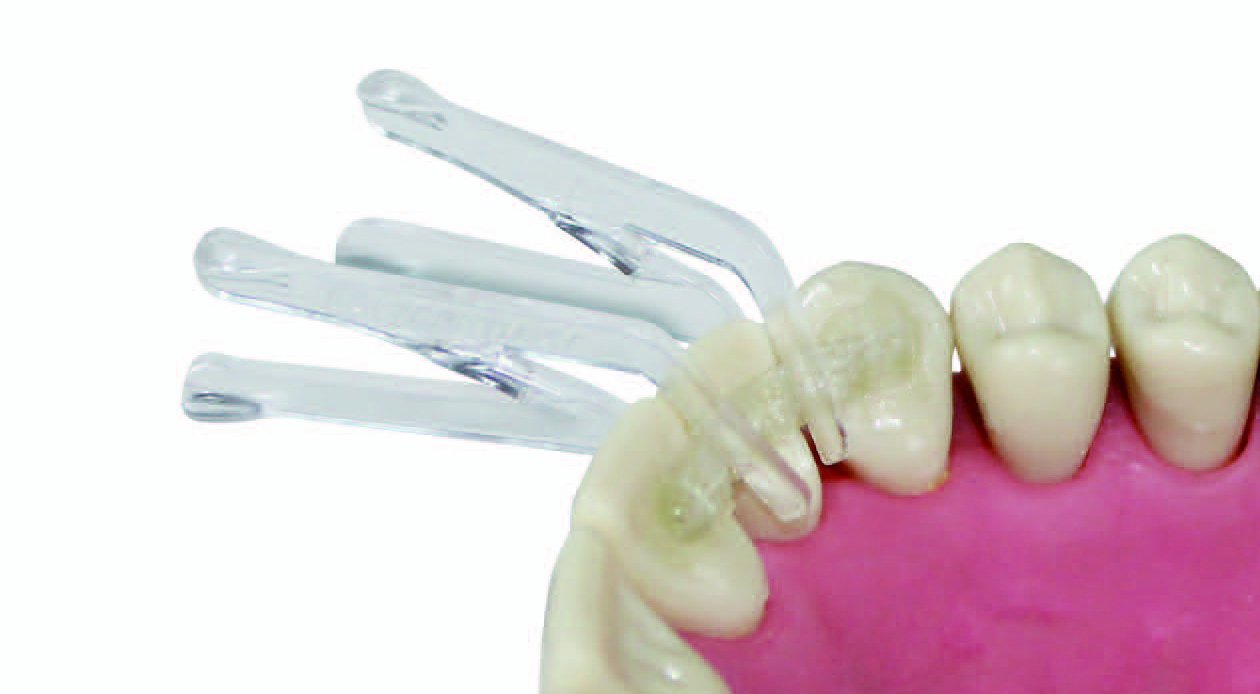 Clip&Splint Pinces de fixation - Deprophar